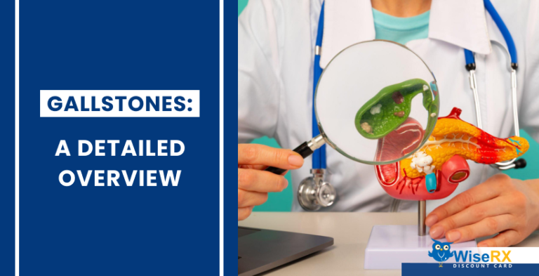 Ultimate Guide to Gallstones